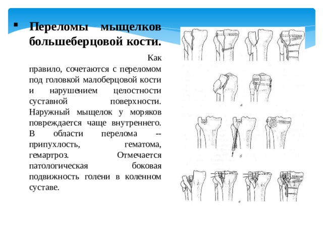 Оказание первой медицинской помощи при открытых и закрытых переломах ...