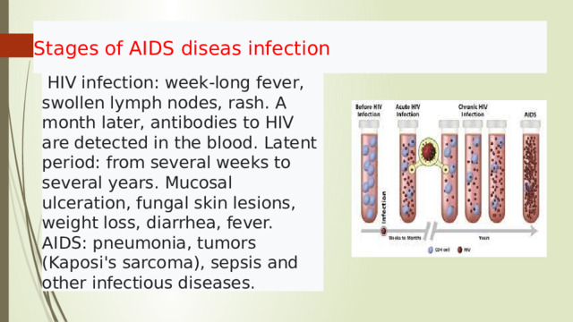 Презентация на тему "AIDS"